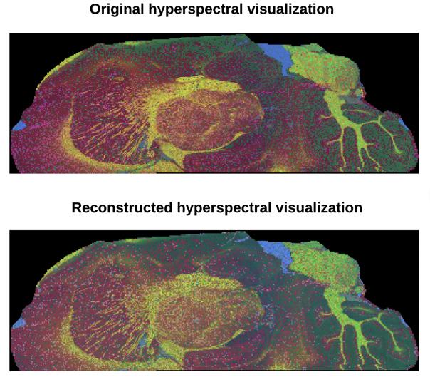 Computational method provides faster high-resolution MS imaging ...
