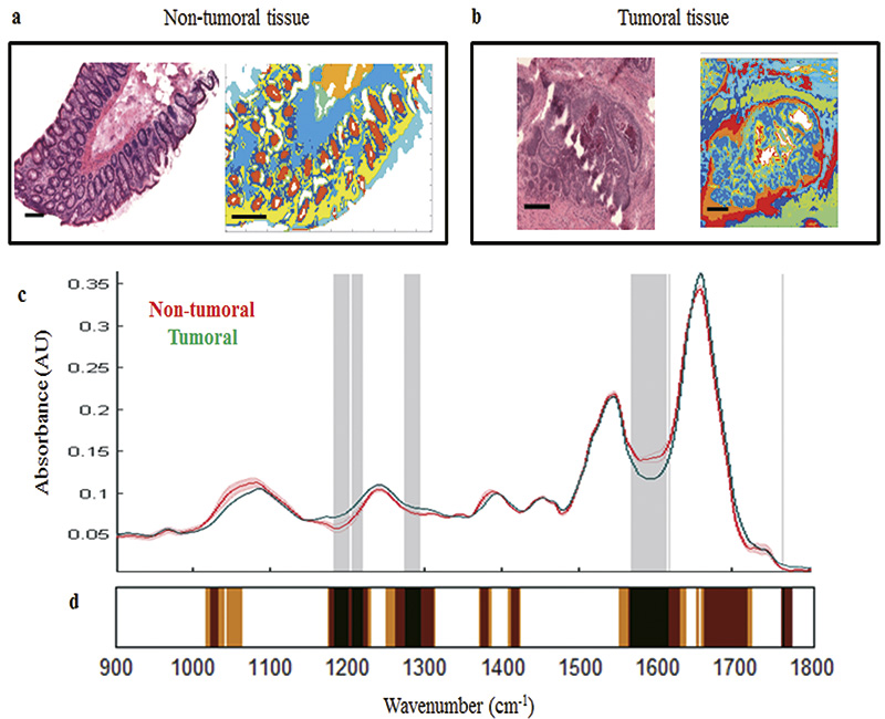 Novel concepts in infrared spectral imaging as a cancer diagnostic tool ...