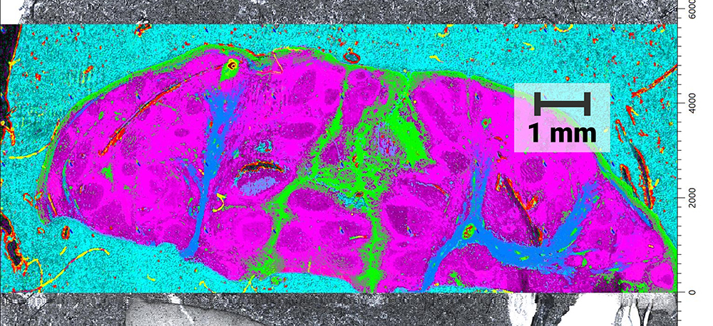 Biological tissue analysis by infrared laser imaging (QCL ...