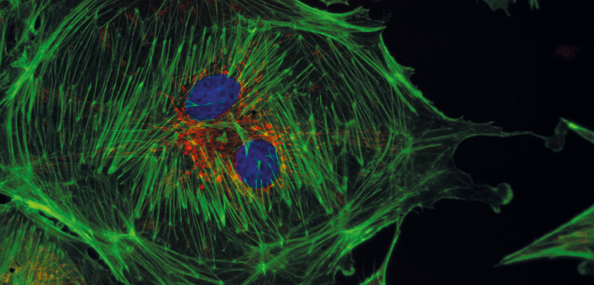 Understanding electron multiplying gain | Spectroscopy Europe/World